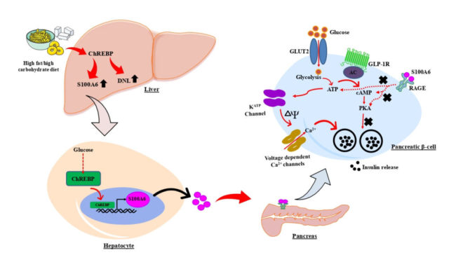 IIT Mandi discovers biochemical link between fatty liver disease and ...